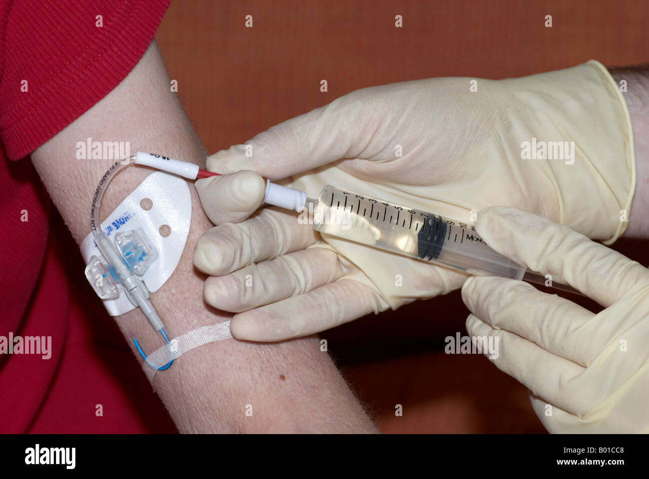 Flushing a picc line peripherally inserted central catheters with Stock ... Flushing a picc line peripherally inserted central catheters with Stock ...