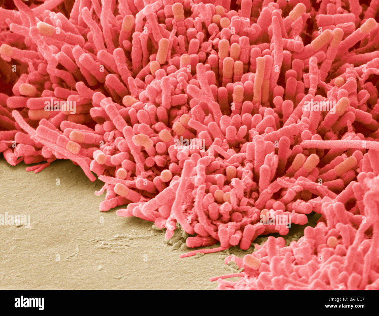 Plaque-forming bacteria, coloured scanningelectron micrograph (SEM ... Plaque-forming bacteria, coloured scanningelectron micrograph (SEM ...