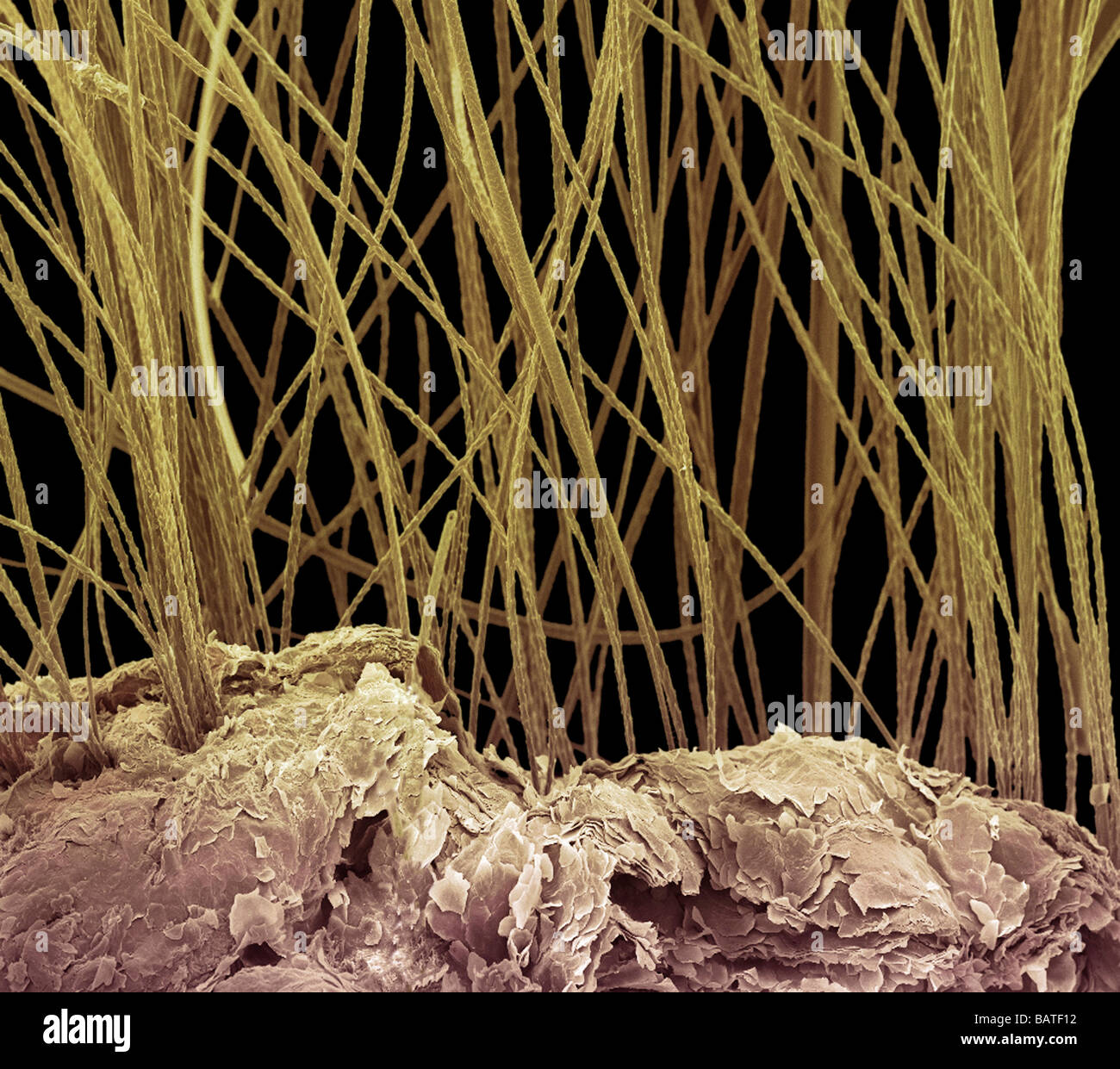Dog hair, coloured scanning electron micrograph(SEM Stock Photo ... Dog hair, coloured scanning electron micrograph(SEM Stock Photo ...