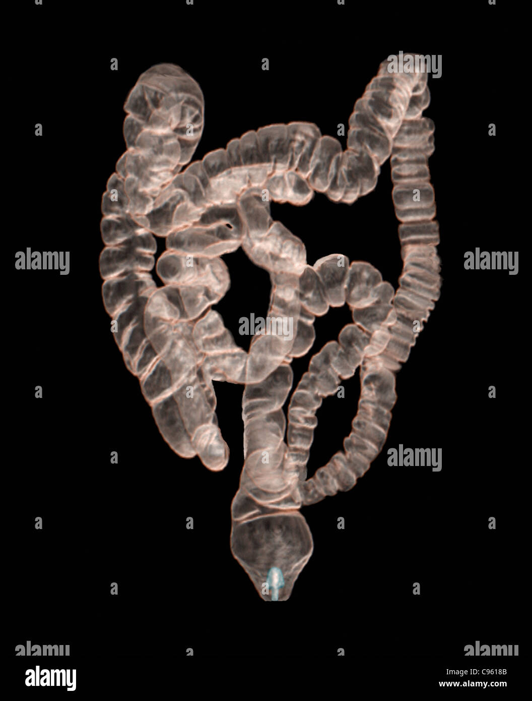 Normal intestines. Coloured 3D computed tomography (CT) scan of the ... Normal intestines. Coloured 3D computed tomography (CT) scan of the ...