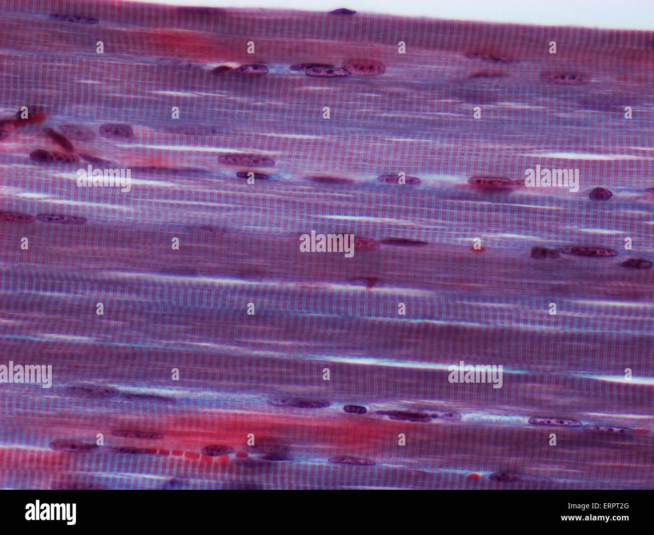 Skeletal muscle. Light micrograph of a longitudinal section through ... Skeletal muscle. Light micrograph of a longitudinal section through ...