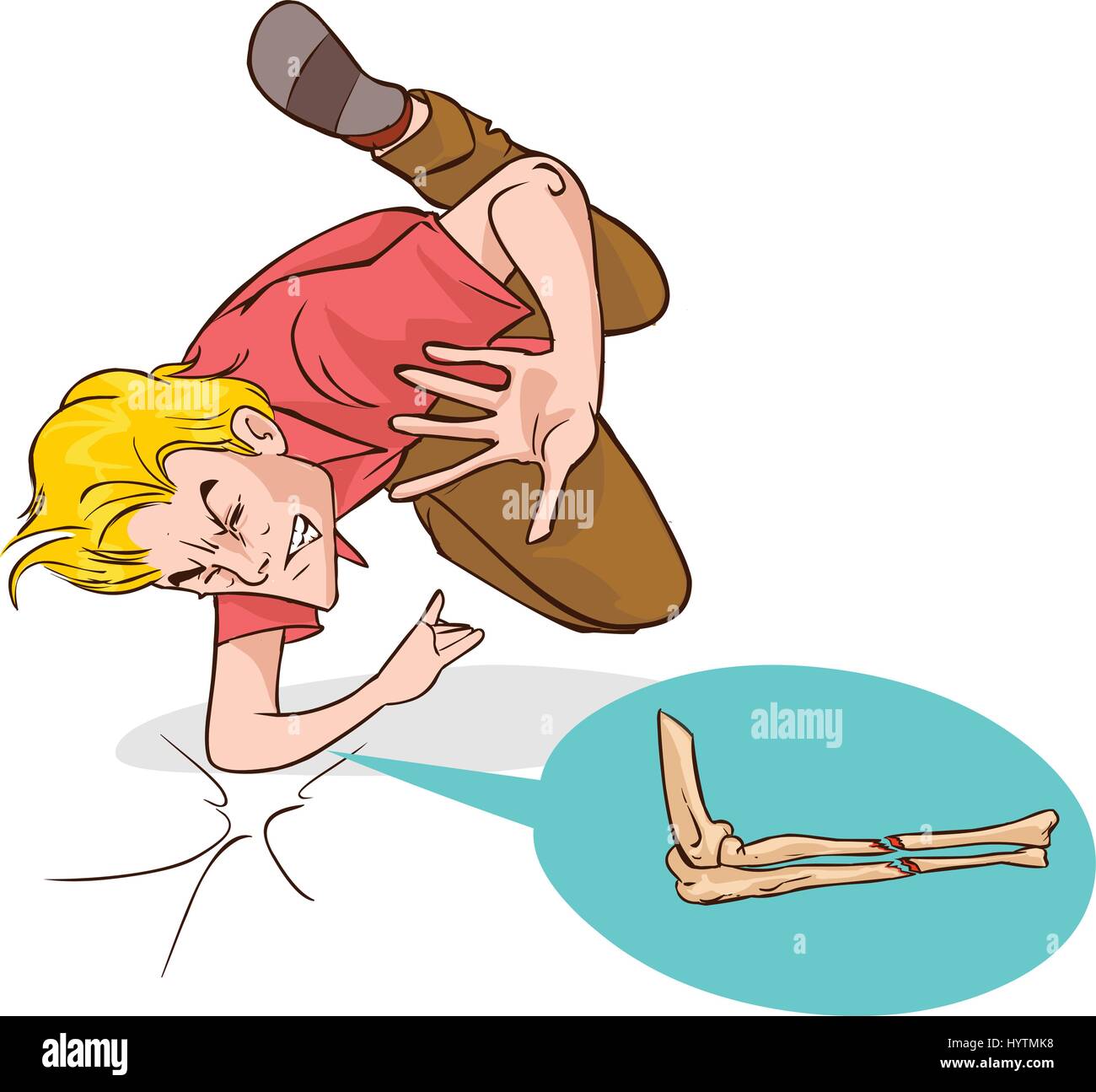 vector illustration of a who broke his arm falling Stock Vector Art ... vector illustration of a who broke his arm falling Stock Vector Art ...