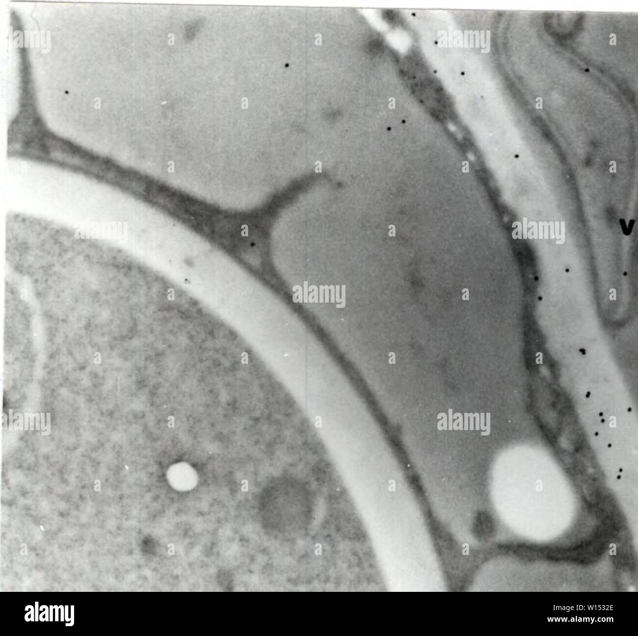 Ascus Hi Res Stock Photography And Images Alamy