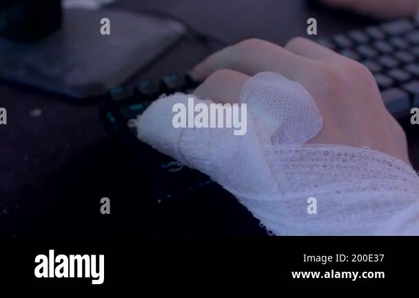 Injured hand with bandage typing on a keyboard, showing personal ...