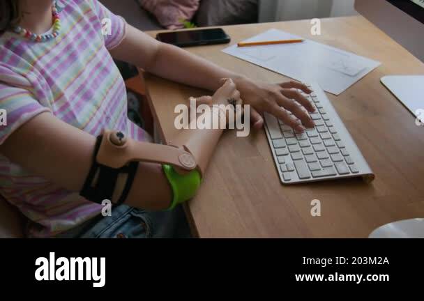 Midsection shot of unknown child with prosthetic arm typing on wireless ...