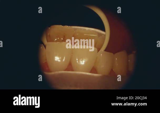 Shot from dental microscope denture tooth cleanliness doctor technician ...