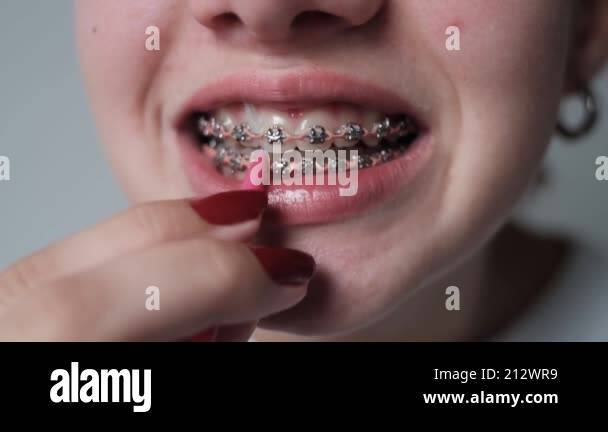 A detailed closeup of dental care, showcasing a person carefully ...