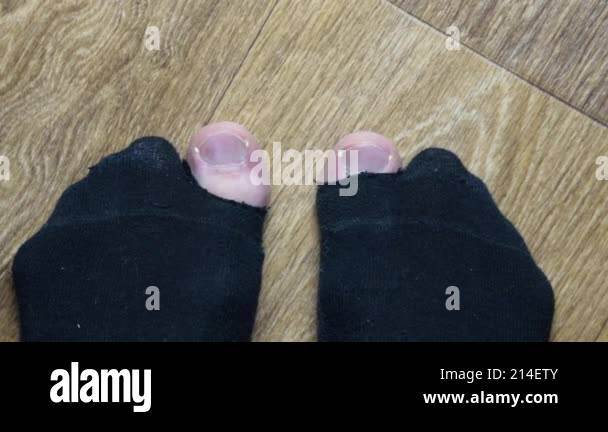A man's feet in old black socks with holes in the big toe Stock Video ...