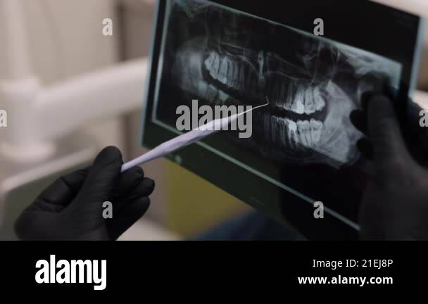 Dental tool, X-ray assessment, Dental imaging. Dental X-ray being ...