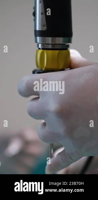 Vertical Screen: Close-up of a surgeons gloved hand holding a precision ...