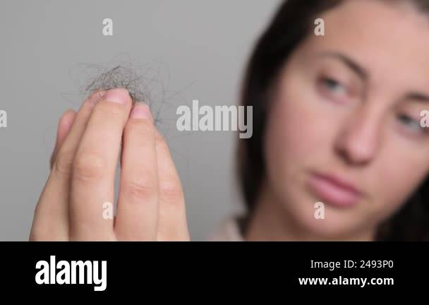 Hand holding drop down hair. Lots of fallen hair. Hair loss problem ...