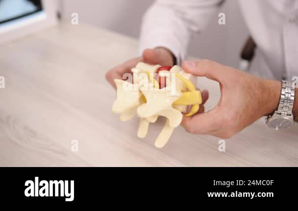 Medical Explanation, Teaching Demonstration, Model Education. Physician ...