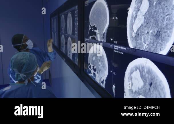 Neurologists, during surgery studying brain scan images on monitors and ...