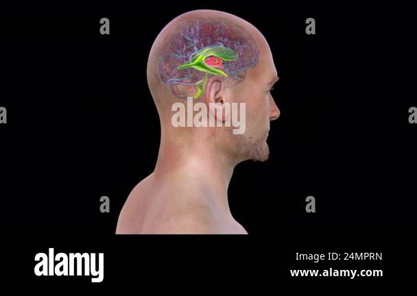 Animation showing the third brain ventricle, a vital component of the ...