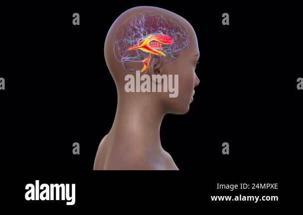 Animation of the ventricular system of the brain. The ventricles are ...