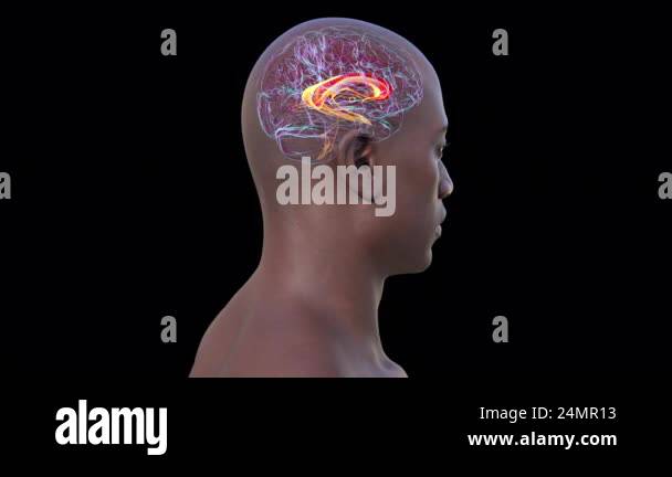 Animation of the human brain with highlighted corpus callosum ...