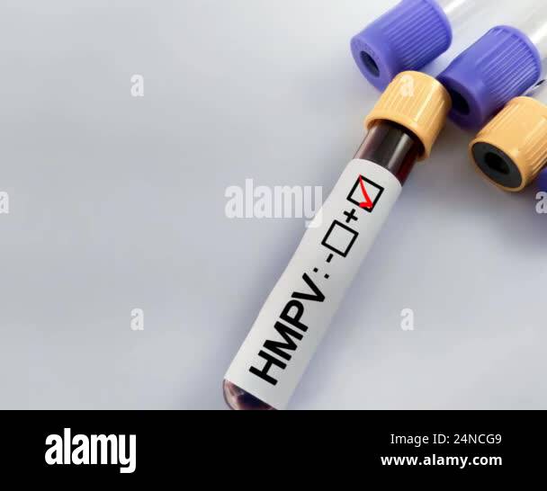 Human metapneumovirus hmpv Stock Videos & Footage - HD and 4K Video ...