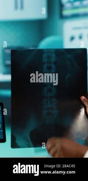 Vertical video Medical professional explaining the x ray imaging for a ...