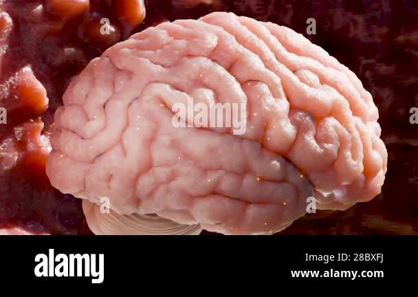 Human brain nervous system anatomy, neural cancer, Sebaceous bulb ...