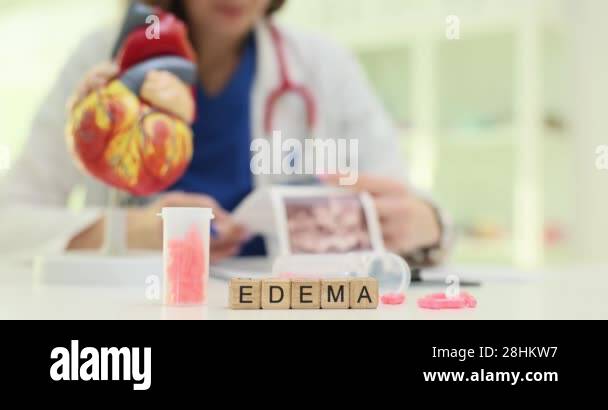 An indepth visual exploration regarding edema, which is related to ...