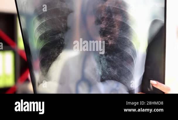 A healthcare provider examines a chest Xray, crucial for accurately ...