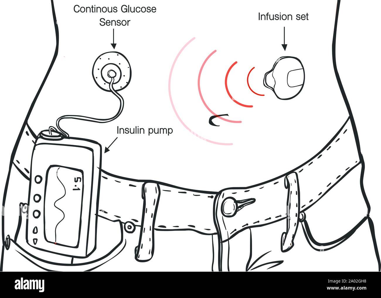 Insulin pump isolated Stock Vector Images - Alamy
