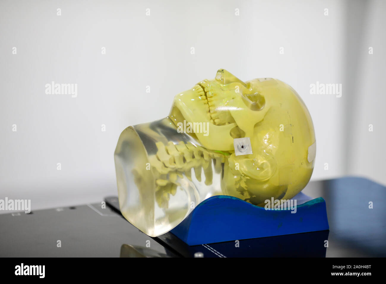 Human tissue mimicking mannequin head on a medical linear accelerator ...