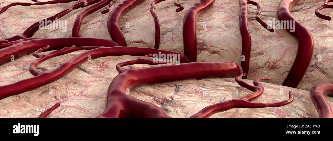 blood loss, circulatory system, disease, Capillary, brain, bleeding ...
