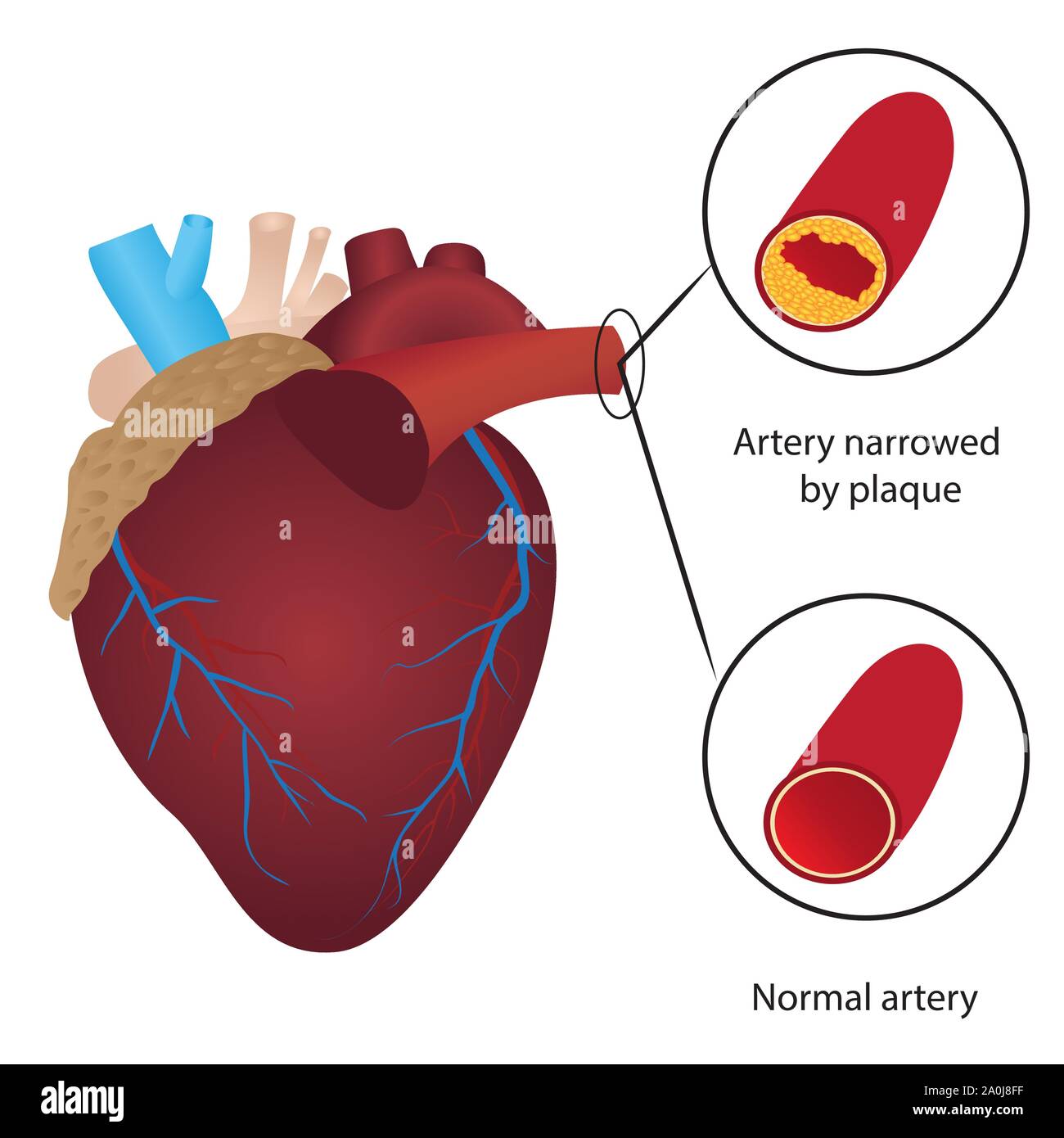 Cholesterol level in blood vessel vector illustration Stock Vector ...