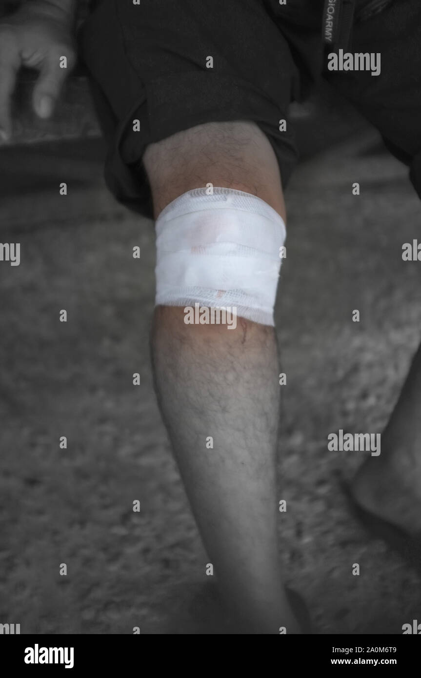 The man having knee problems on grey background, closeup Stock Photo ...