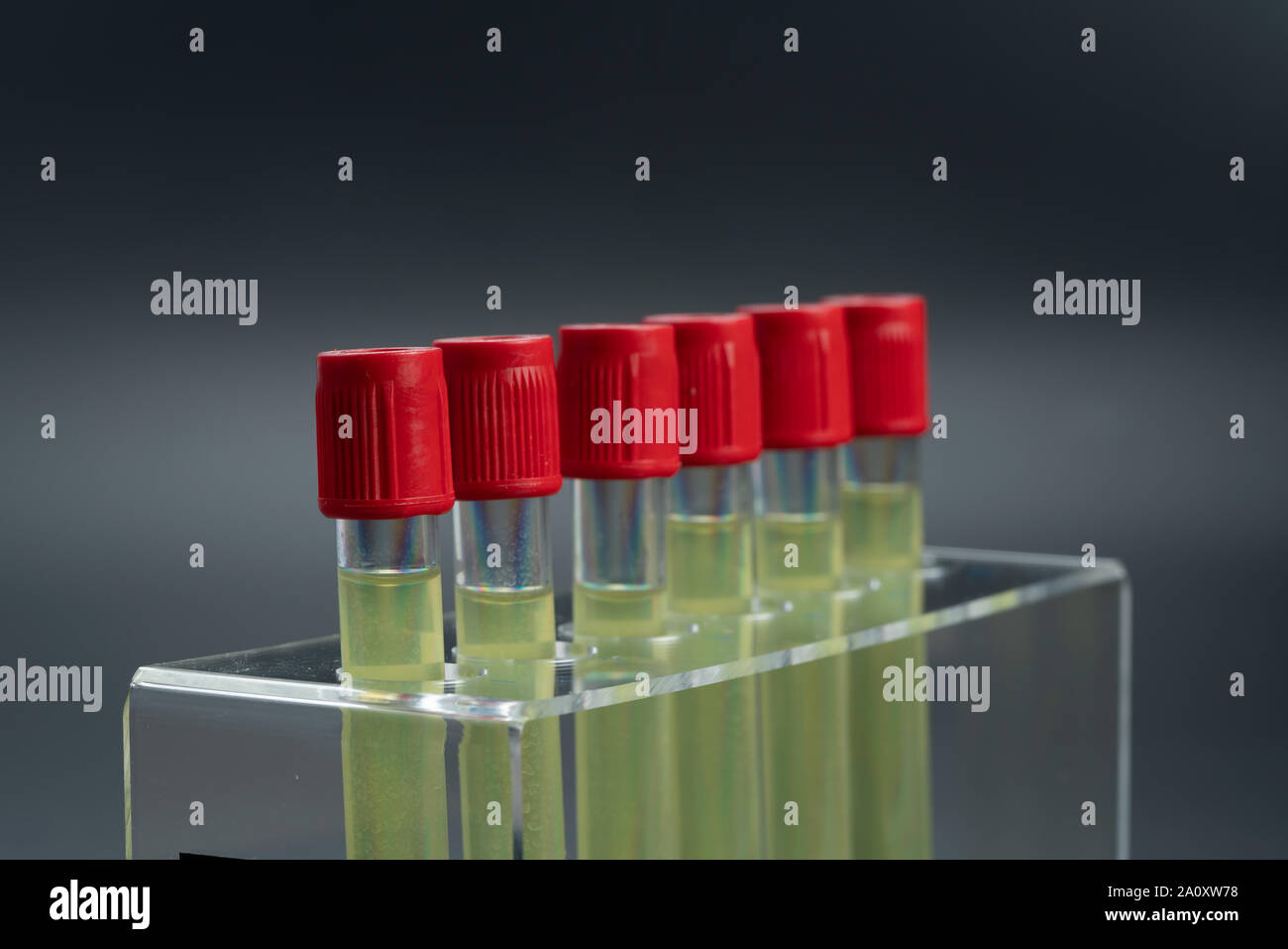 Test tubes with chemical samples in science laboratory Stock Photo - Alamy