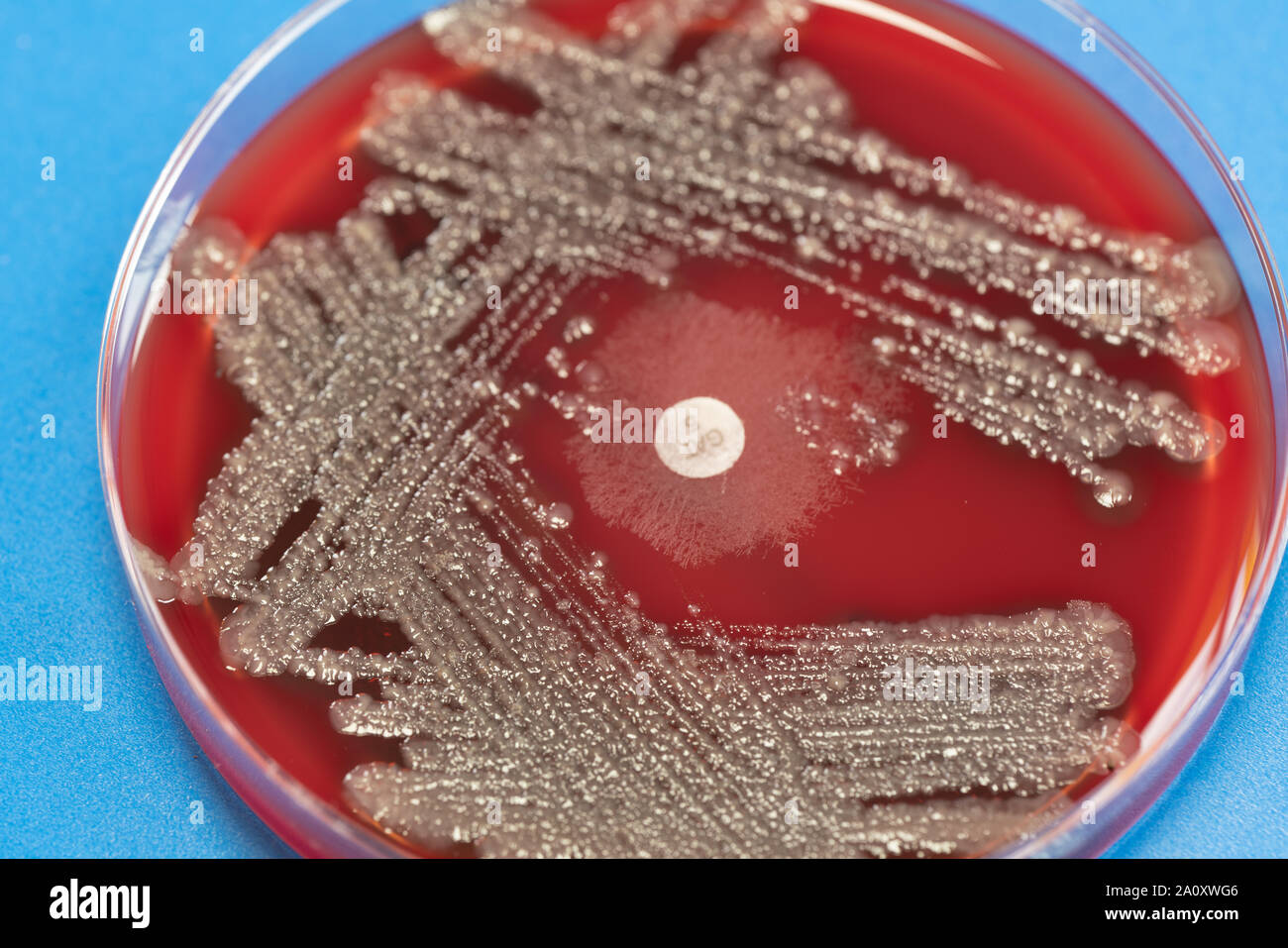 Sowing human feces in a petri dish Stock Photo - Alamy