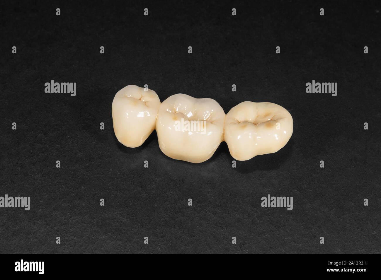 ceramic crowns of human teeth closeup macro isolate on black background ...
