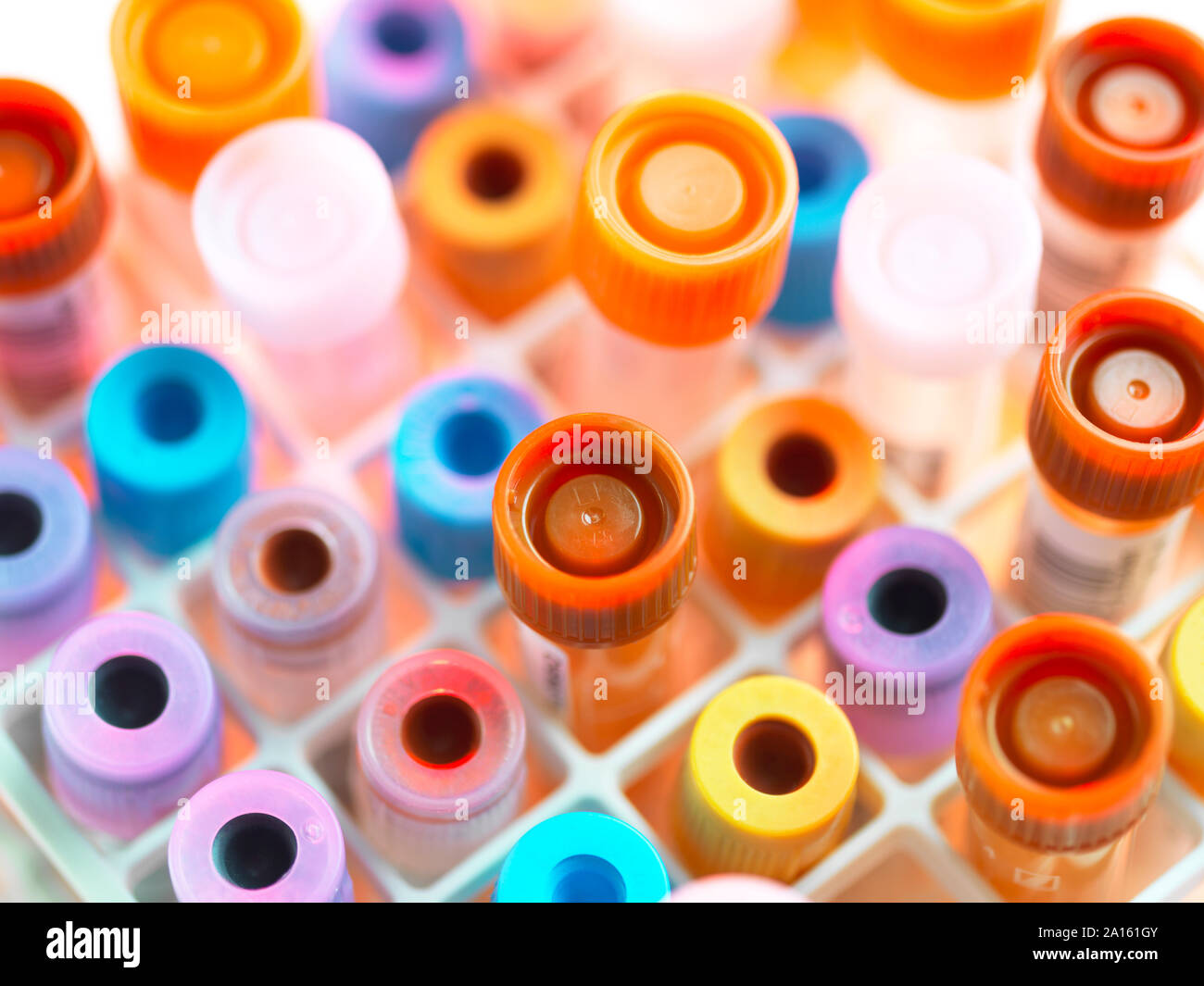Samples in a tray in a laboratory Stock Photo - Alamy