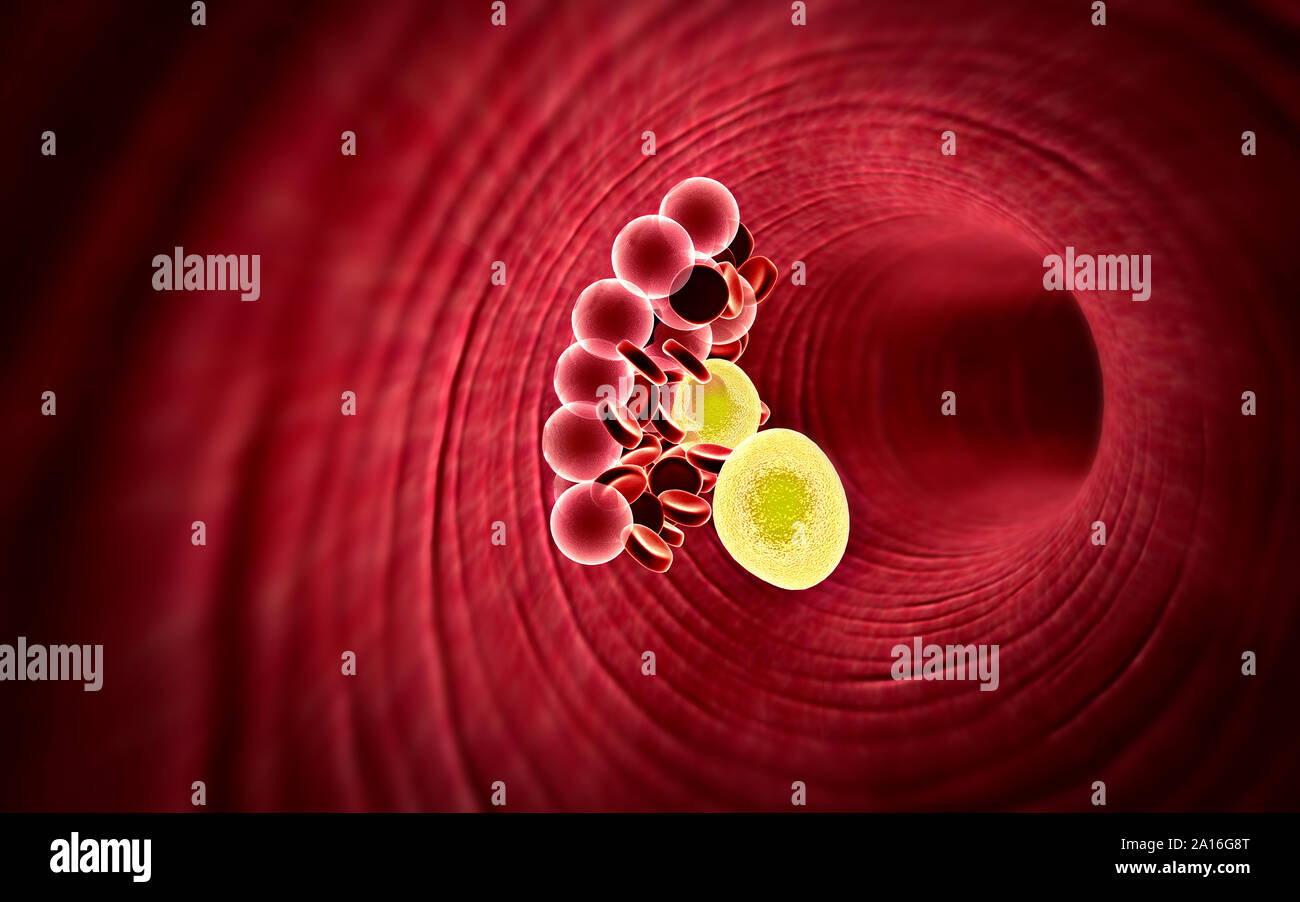 fat cell in the blood Stock Photo - Alamy