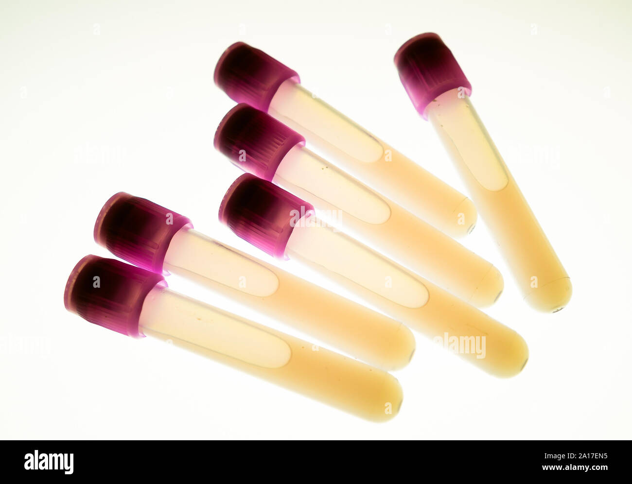Test tubes with samples of biomaterials Stock Photo - Alamy