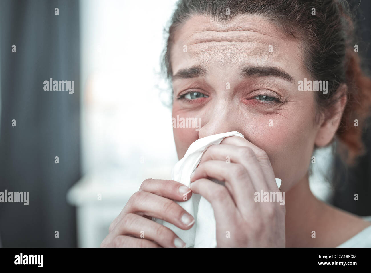 Green-eyed woman drying her running nose after strong allergy Stock ...