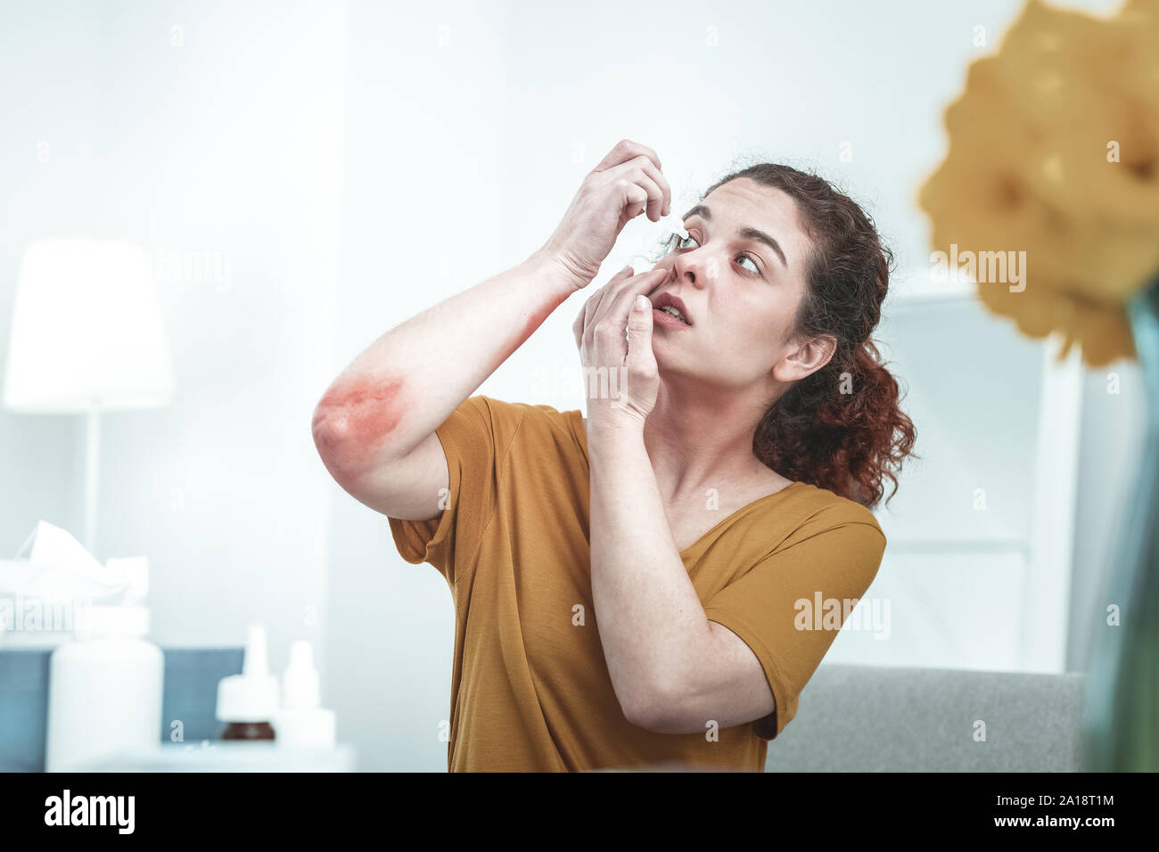 Curly woman with scratches on elbow dropping her eyes Stock Photo - Alamy