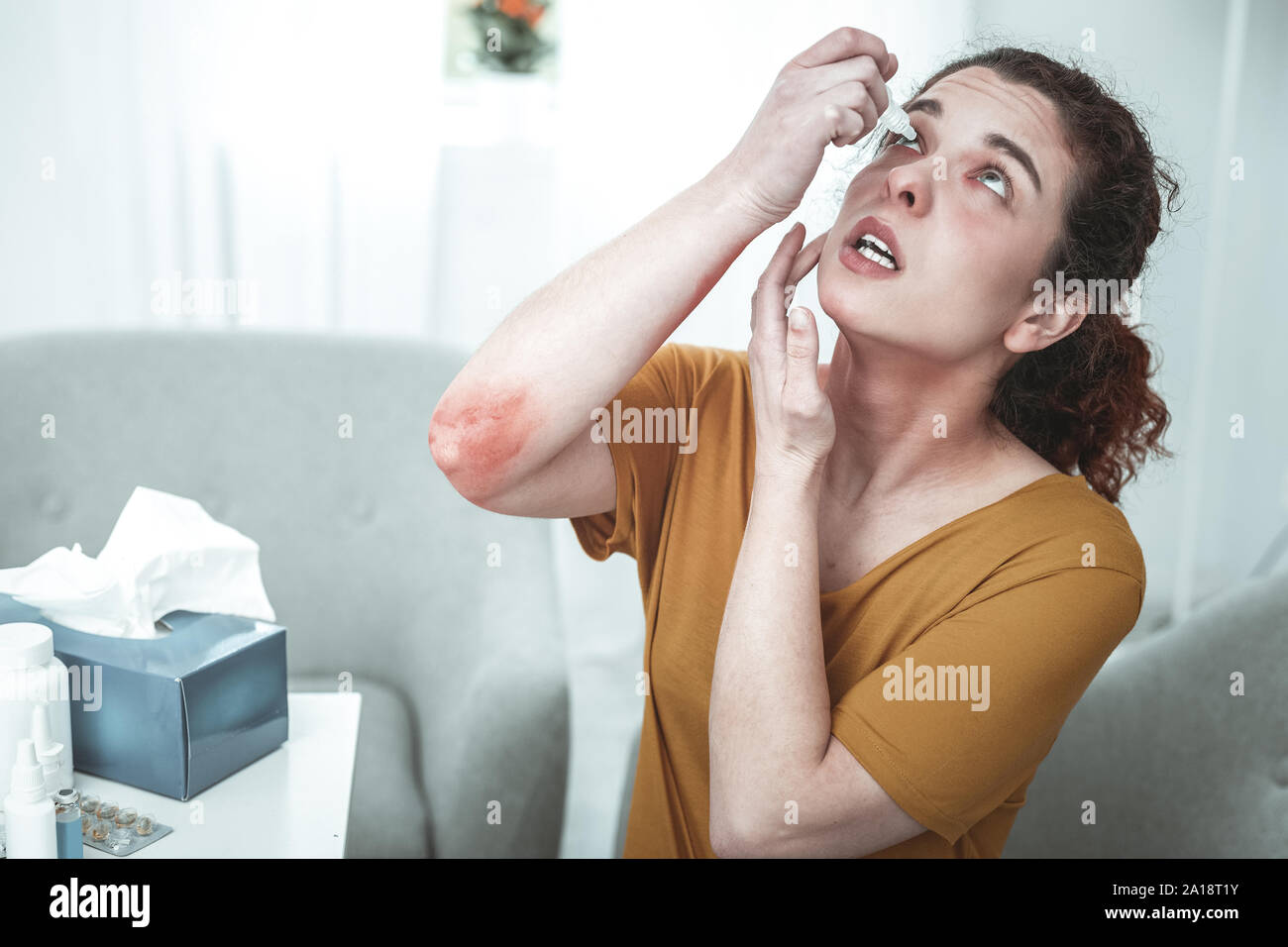 Woman with scratch marks on her elbow using eye drops Stock Photo - Alamy