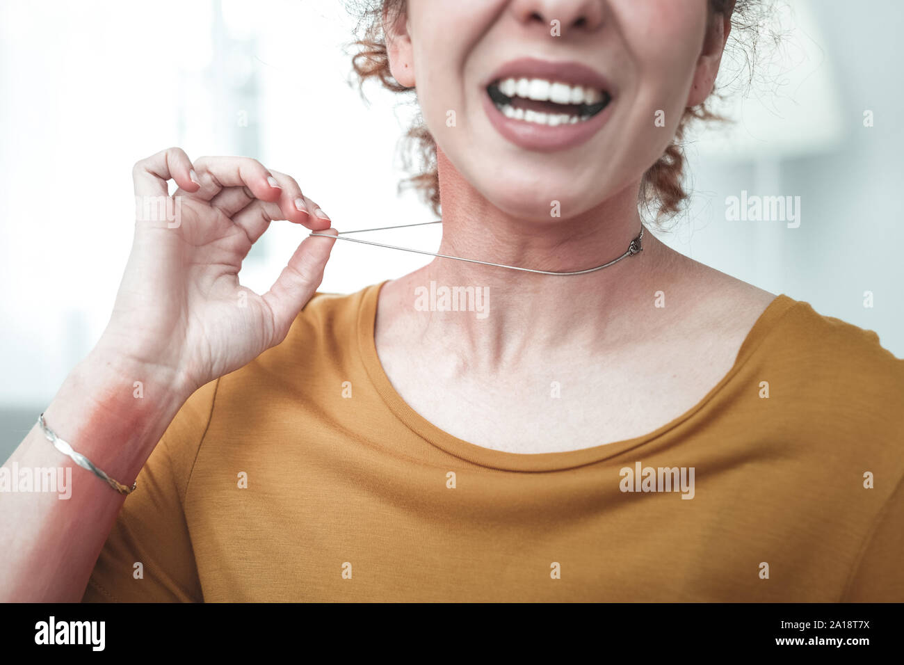 Woman rash neck hi-res stock photography and images - Alamy