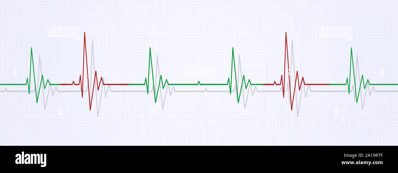 medical banner illustrating irregular heart beat on ecg. heart ...