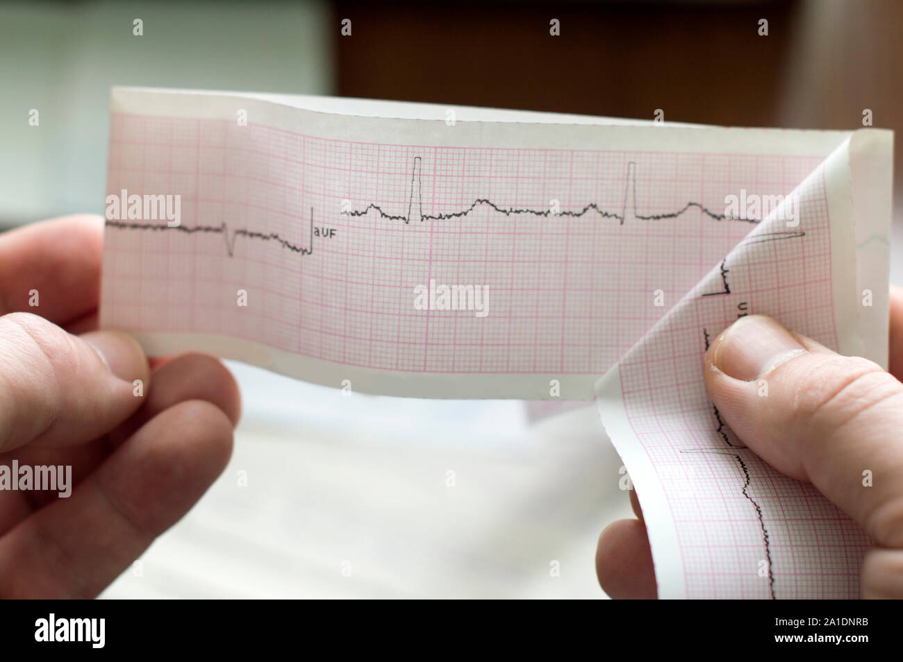 ECG of the patient in the doctor's hands against the background of an ...