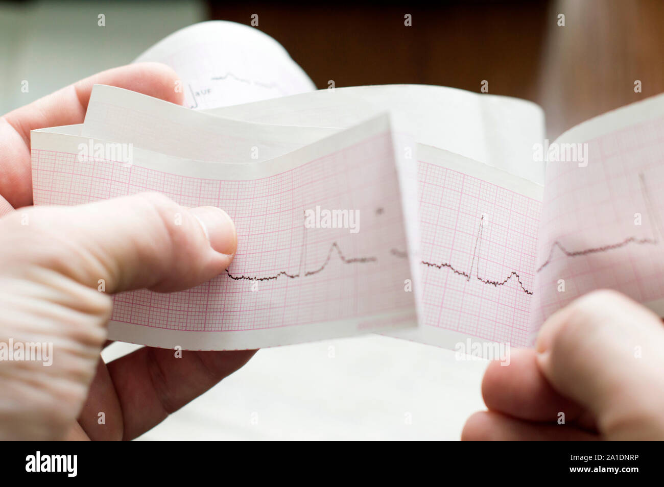 ECG of the patient in the doctor's hands against the background of an ...