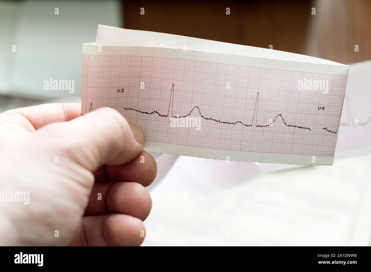 ECG of the patient in the doctor's hands against the background of an ...