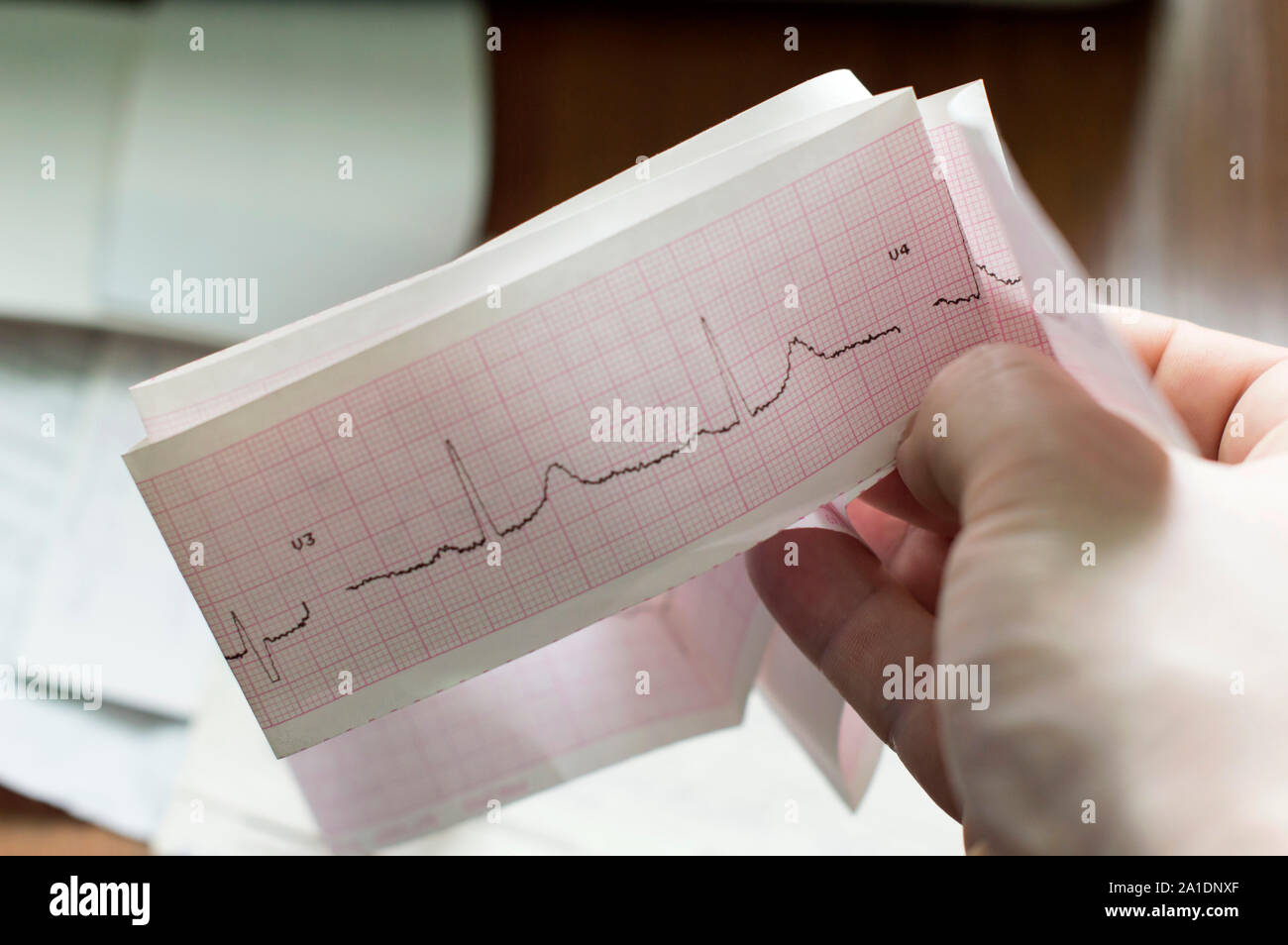 ECG of the patient in the doctor's hands against the background of an ...