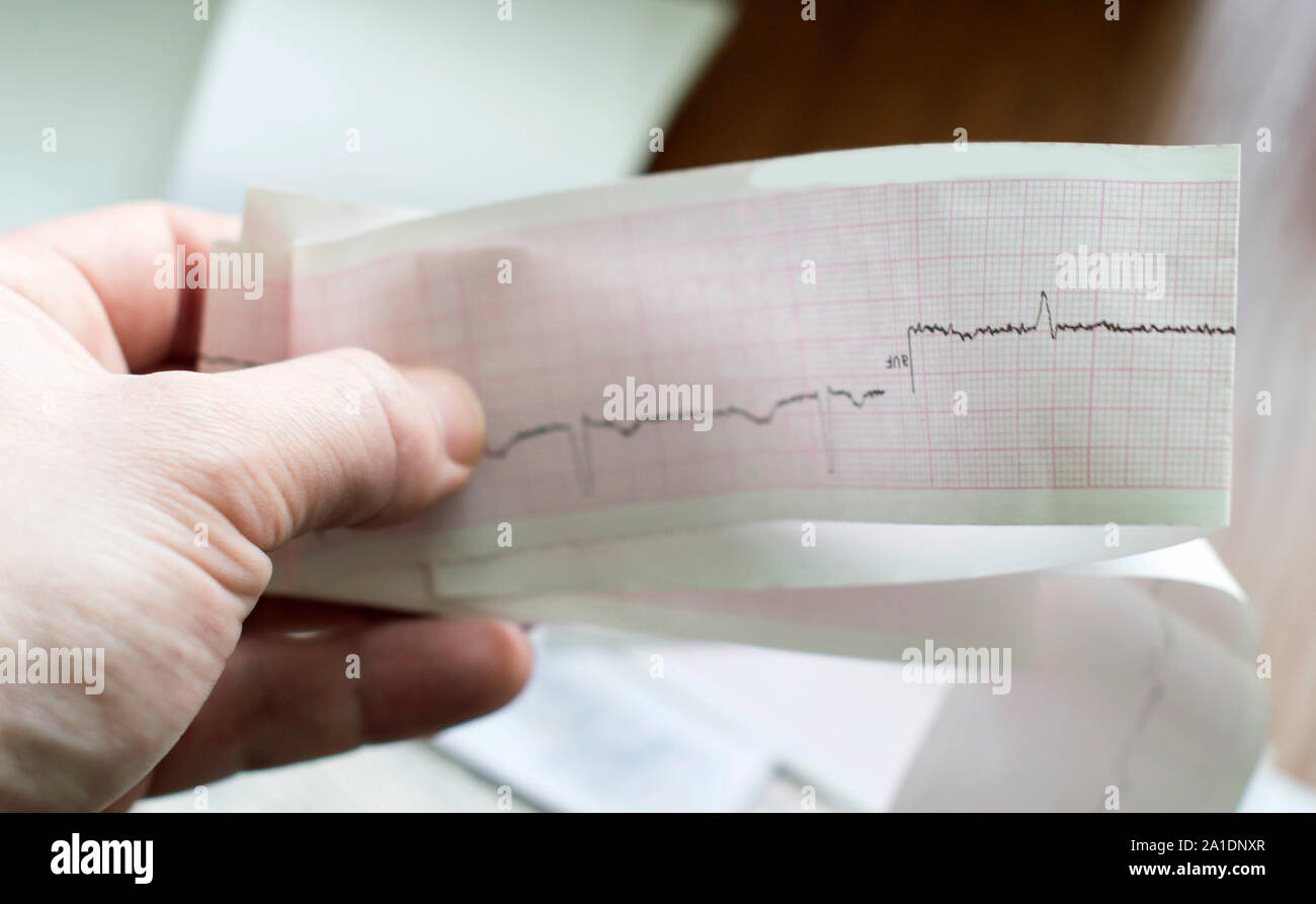 ECG of the patient in the doctor's hands against the background of an ...