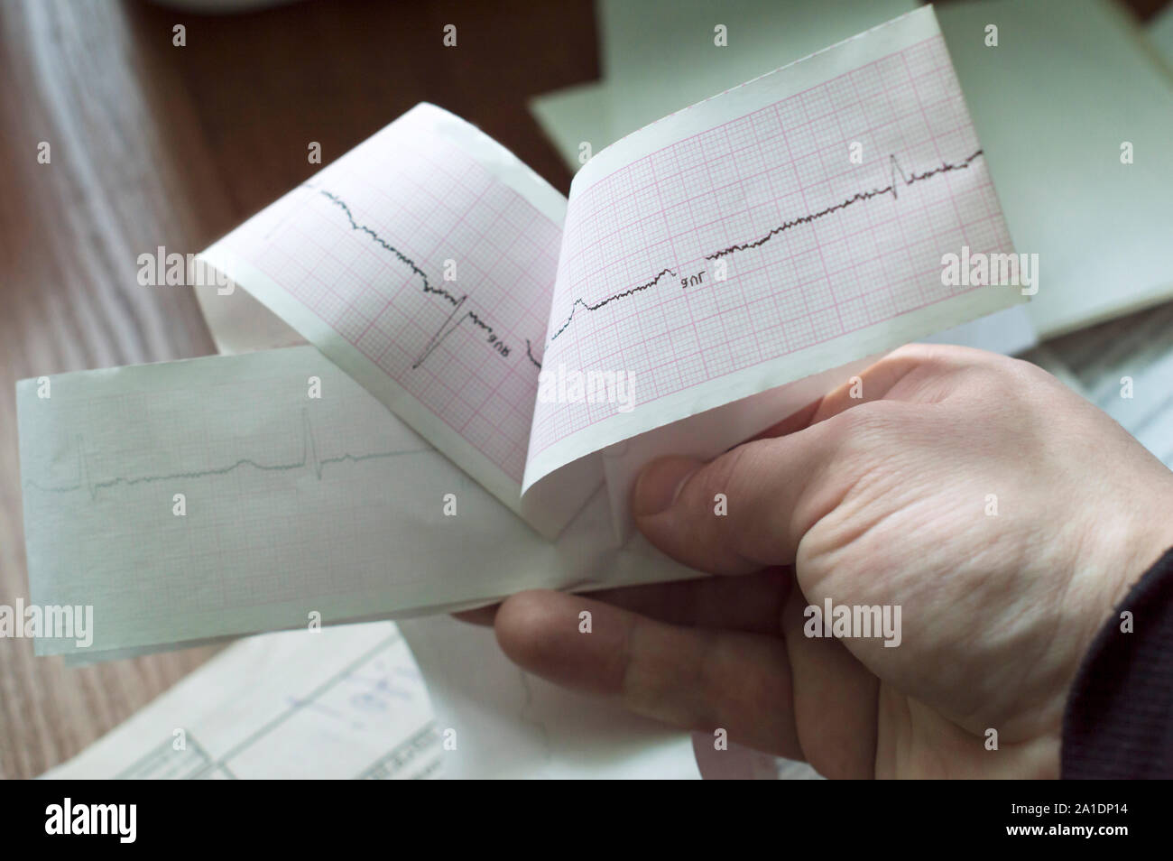 ECG of the patient in the doctor's hands against the background of an ...