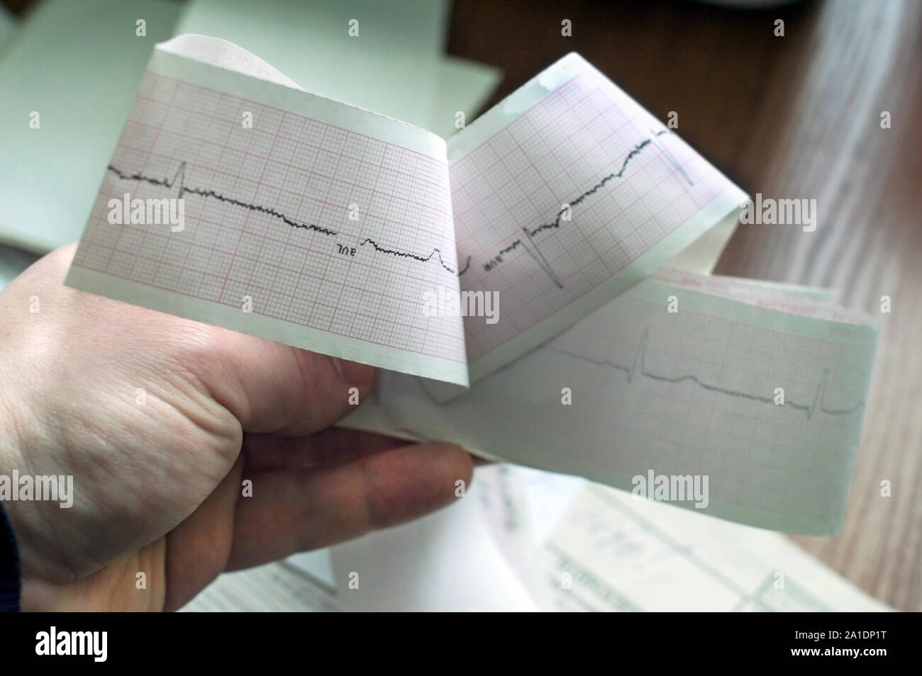 ECG of the patient in the doctor's hands against the background of an ...