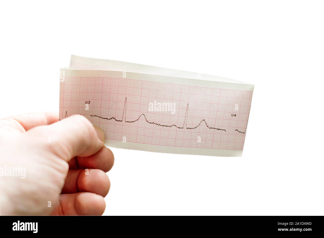 ECG of the patient in the doctor's hand on a white background Stock ...