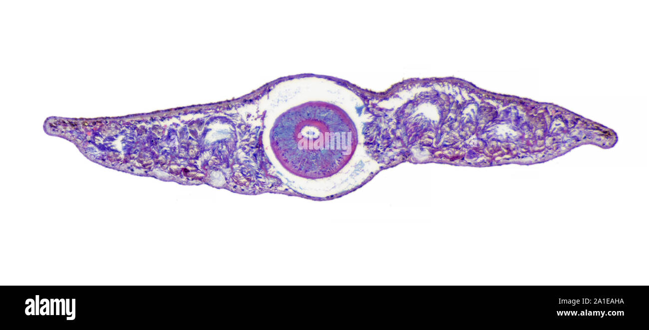 Planarian body, stained section TS, one of many flatworms of the class ...